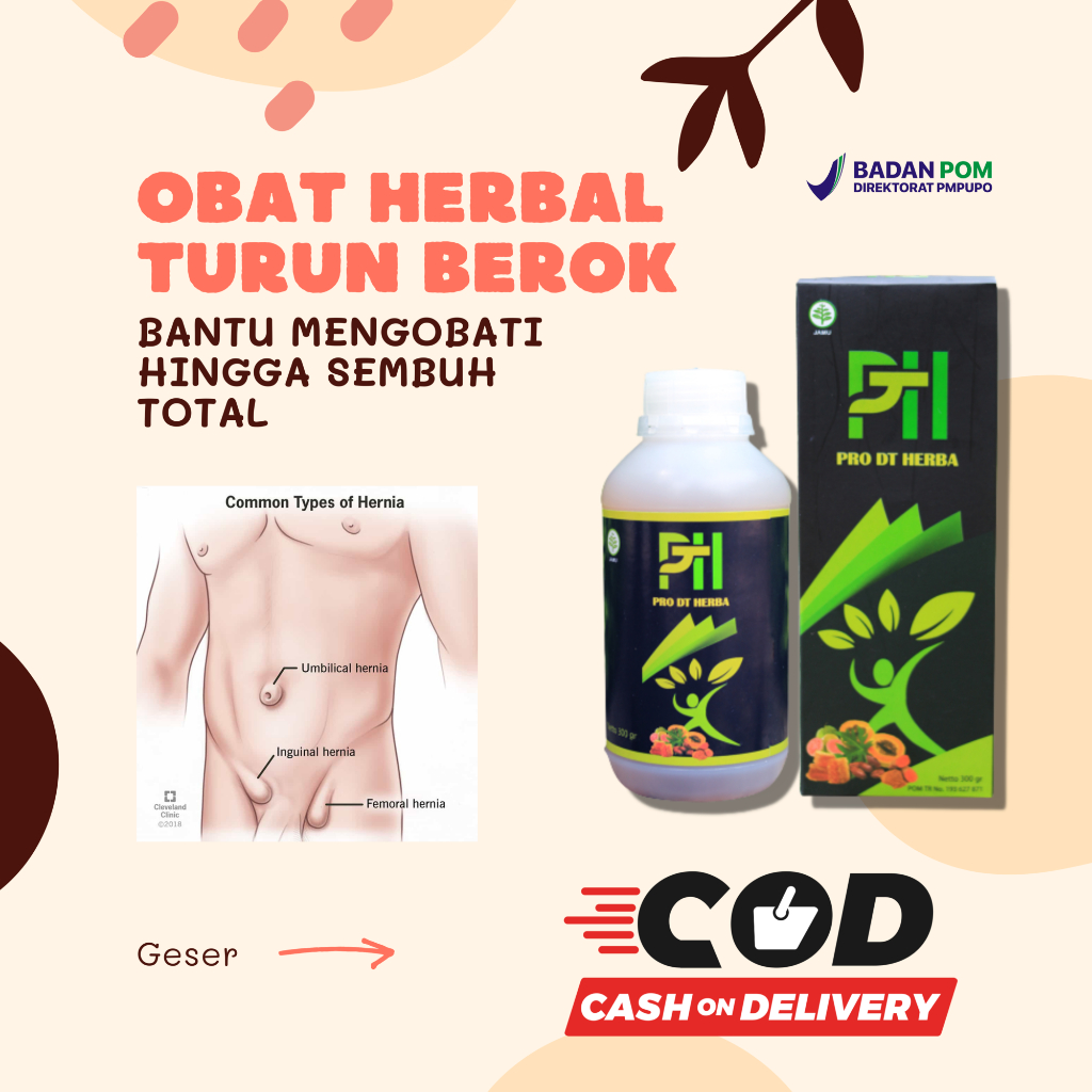 Jual Obat Turun Berok, Obat Hernia Tanpa Operasi, Obat Hernia Anak ...