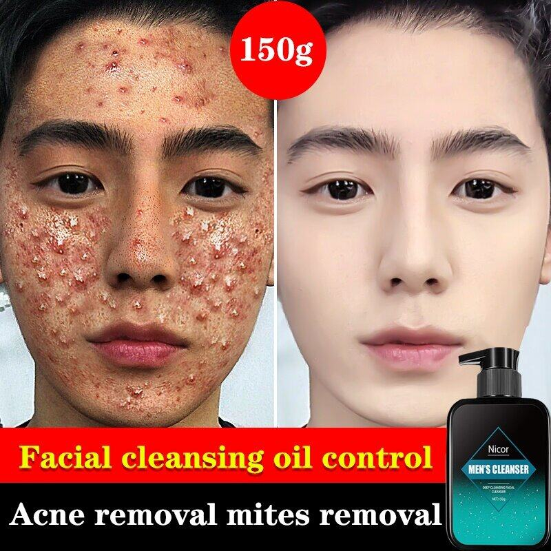 Jual Facial cleanser pencuci muka lelaki Sabun Muka Jerawat Ubat Acne ...
