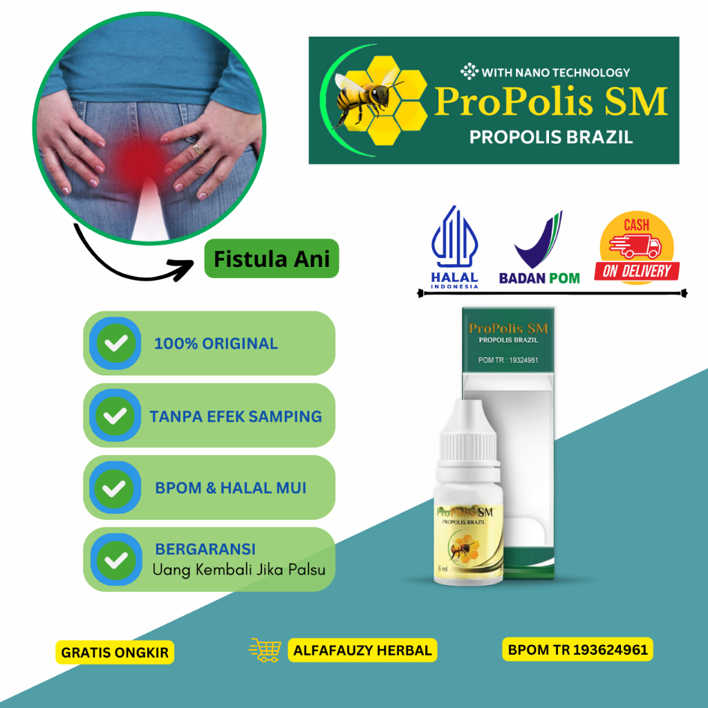 Jual Obat fistula ani Herbal Propolis SM Brazil 100% Original | Shopee ...