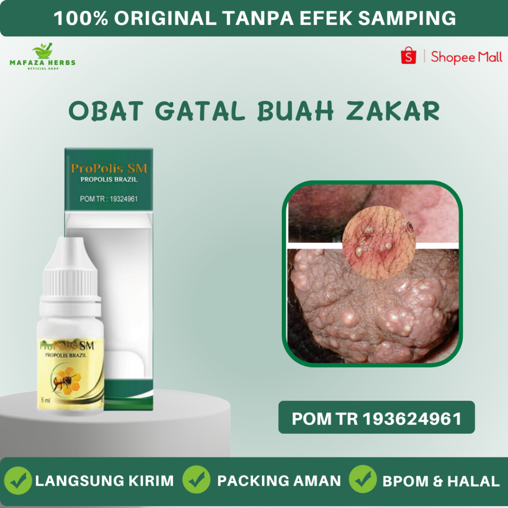 Jual Obat Gatal Buah Zakar Pria, Obat Bentol Di Buah Zakar/Jakar Pria ...