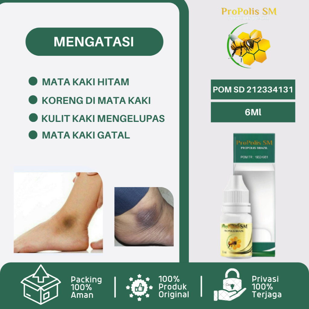 Jual Obat Mata Kaki Hitam, Pemutih Mata Kaki Yang Hitam, Obat Koreng Di ...