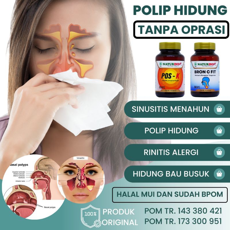 Jual Obat Polip Hidung Sinusitis Rhinitis Alergi Herbal Ampuh | Shopee ...