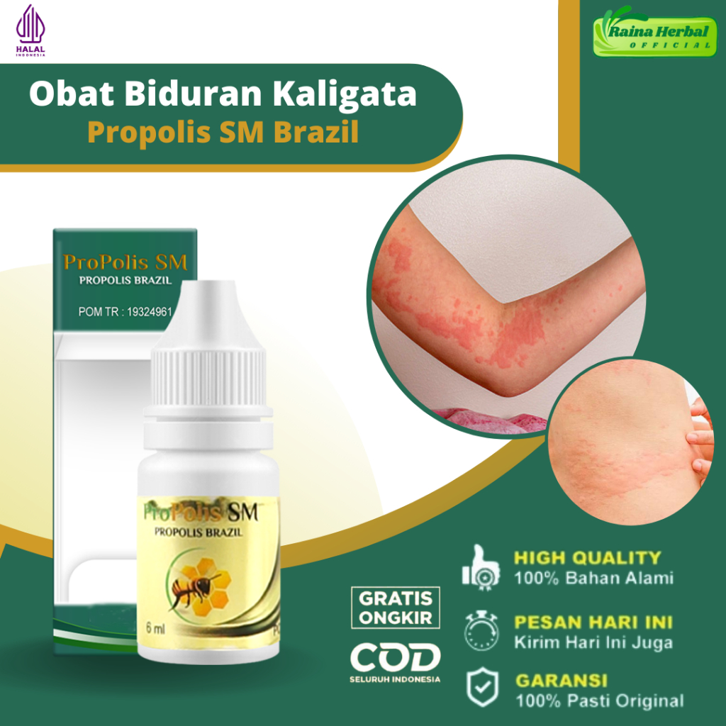 Jual Raina Herbal - Obat Oles Biduran, Obat Kaligata, Obat Alergi ...