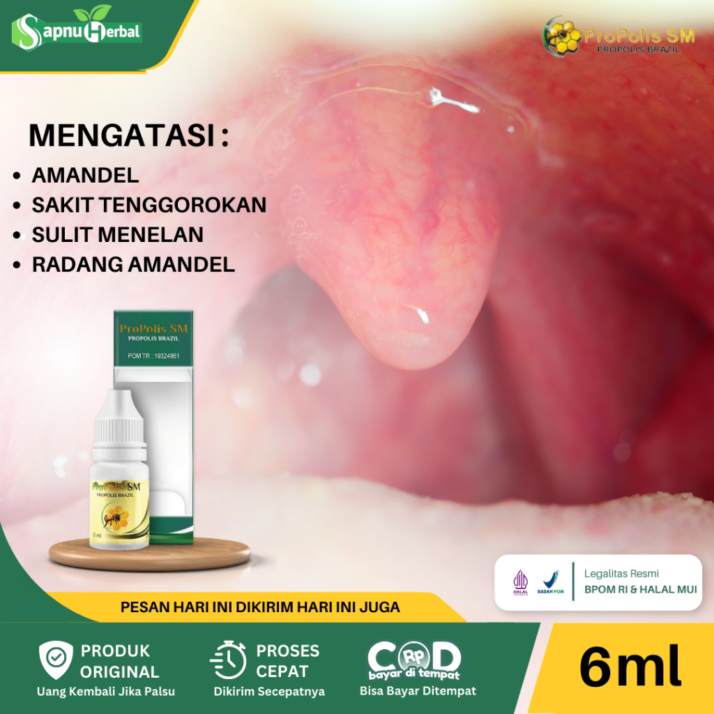 Jual Obat Amandel, Obat Radang Amandel, Obat Amandel Kronis, Obat ...