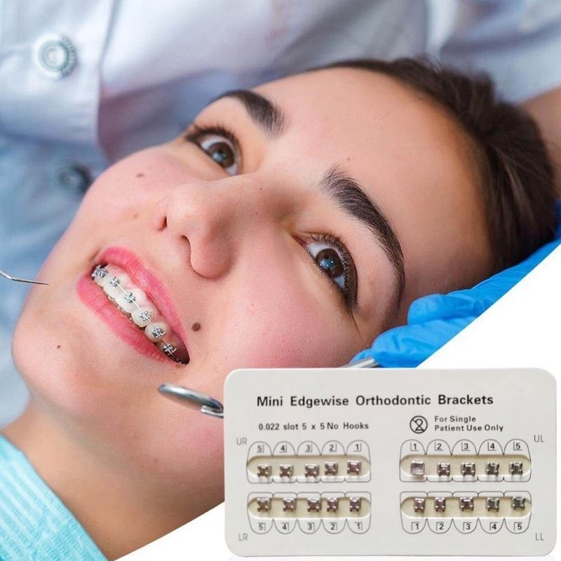 Jual Mini Edgewise Bracket Orthodontic Behel Gigi | Shopee Indonesia