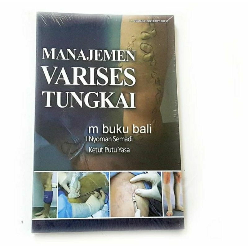 Jual Manajemen Varises Tungkai buku | Shopee Indonesia