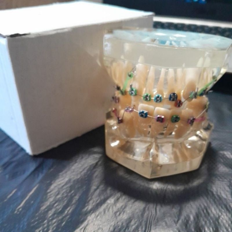 Jual model study ortodontik transparan/dental model study/phantom gigi ...