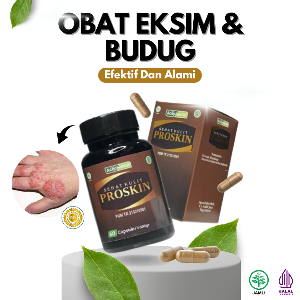 Jual Obat Eksim Budug Bernanah Dermatitis Kapsul Proskin Herbal 100% ...