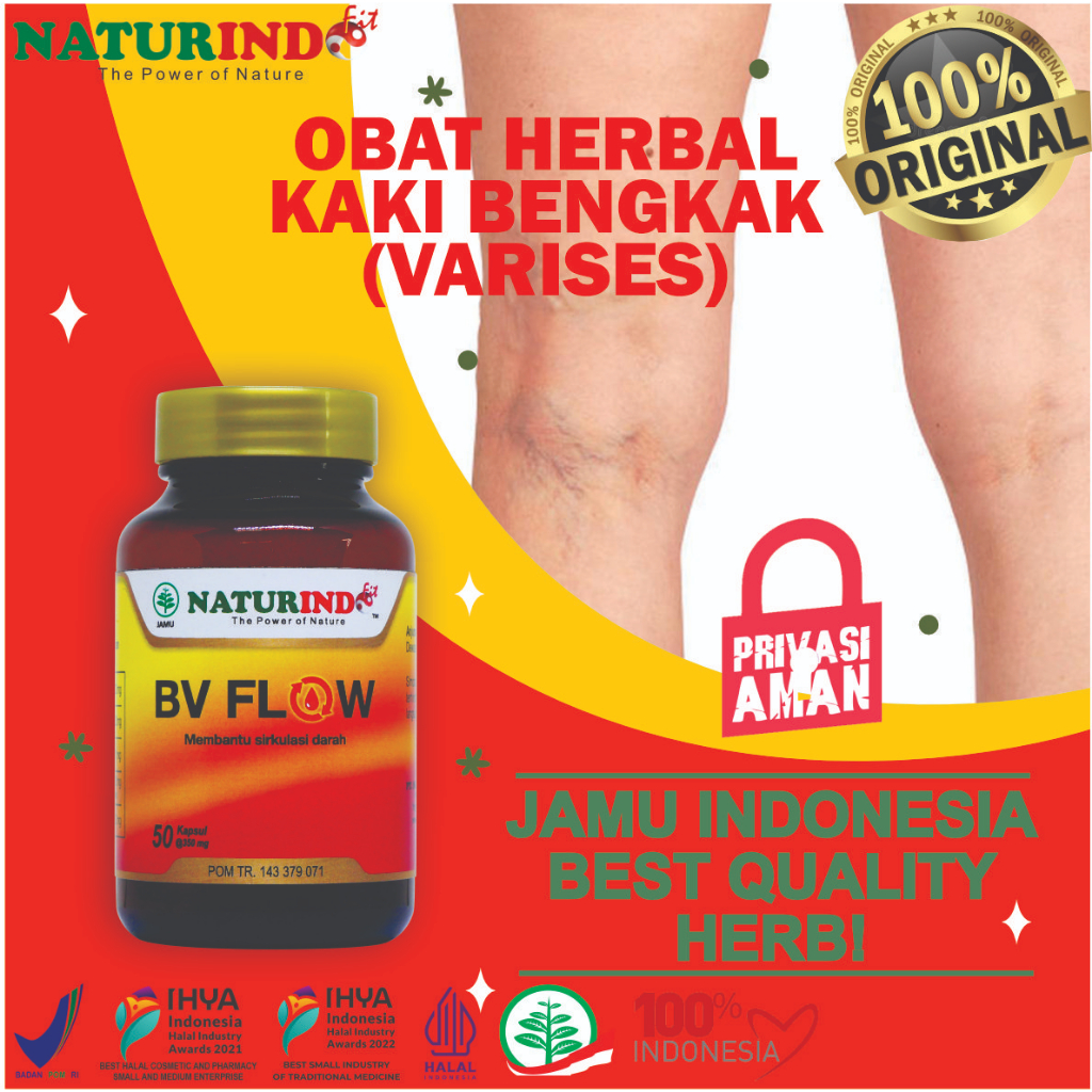 Jual Obat Herbal Varises Otot Kaki Bengkak Di Betis Dan Pelancar Aliran ...