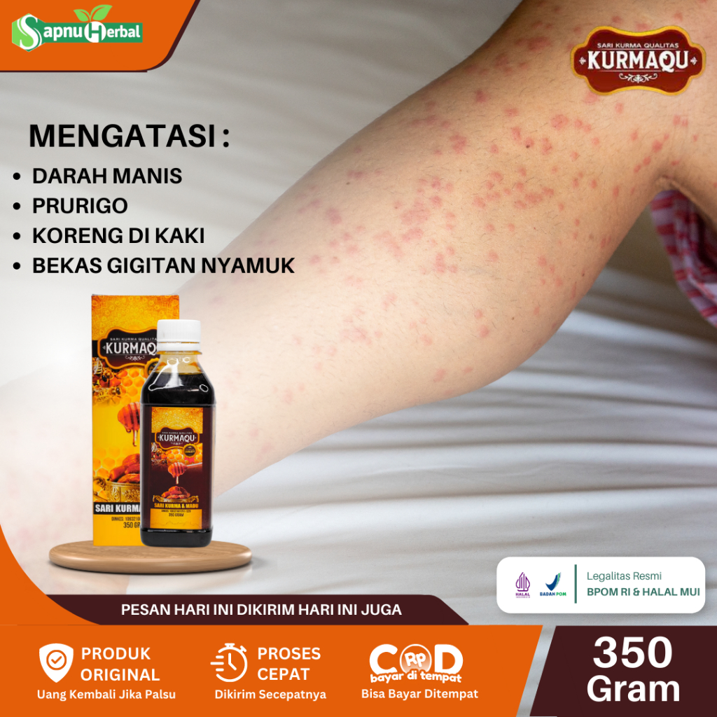 Jual Sapnu Herbal - Obat Darah Manis, Koreng Di Kaki, Gatal Amis Daging ...