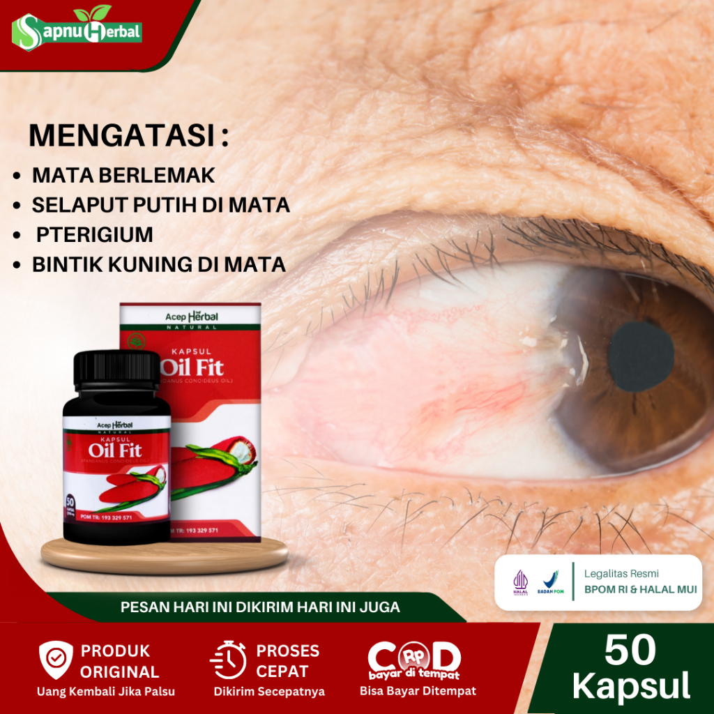 Jual Obat Mata Berlemak Kekuningan, Penyakit Pterigium, Penghilang Selaput Putih Di Mata, Bintik ...