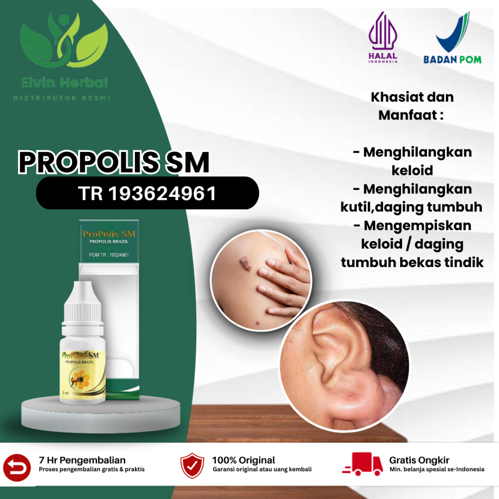 Jual Propolis SM Obat Keloid, Obat keloid Luka tindik, Obat keloid ...