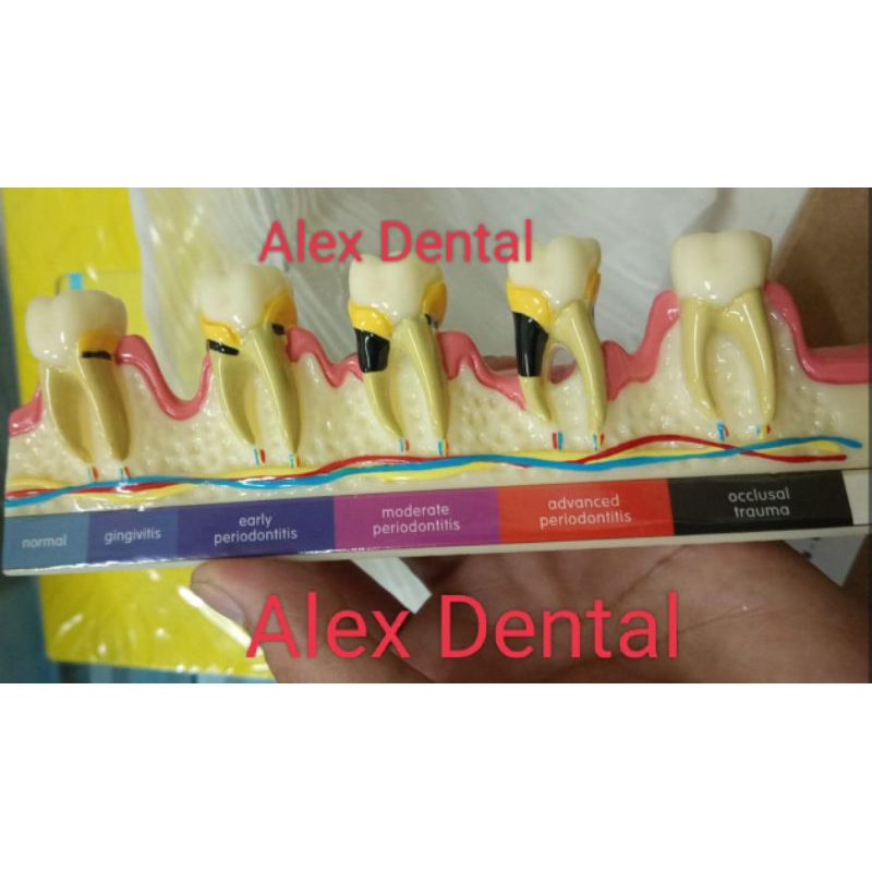 Jual model gigi perio | Shopee Indonesia