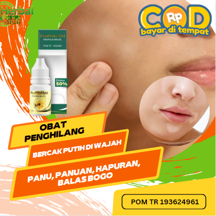 Jual Obat Penghilang Bercak Putih di Wajah, Salep Pembersih Panu ...