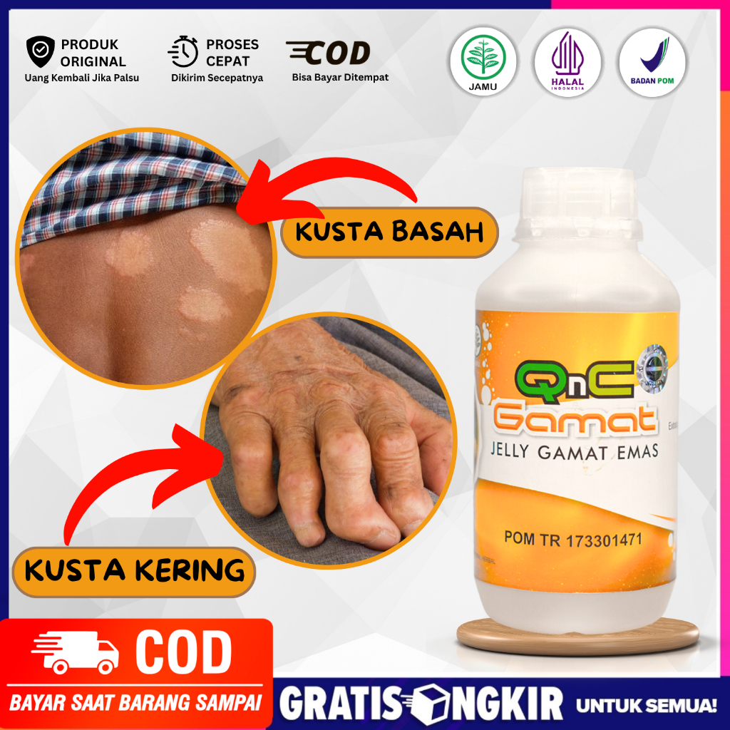 Jual Obat Kusta - Lepra - Kusta Kering - Kusta Basah - Obat Penyakit ...