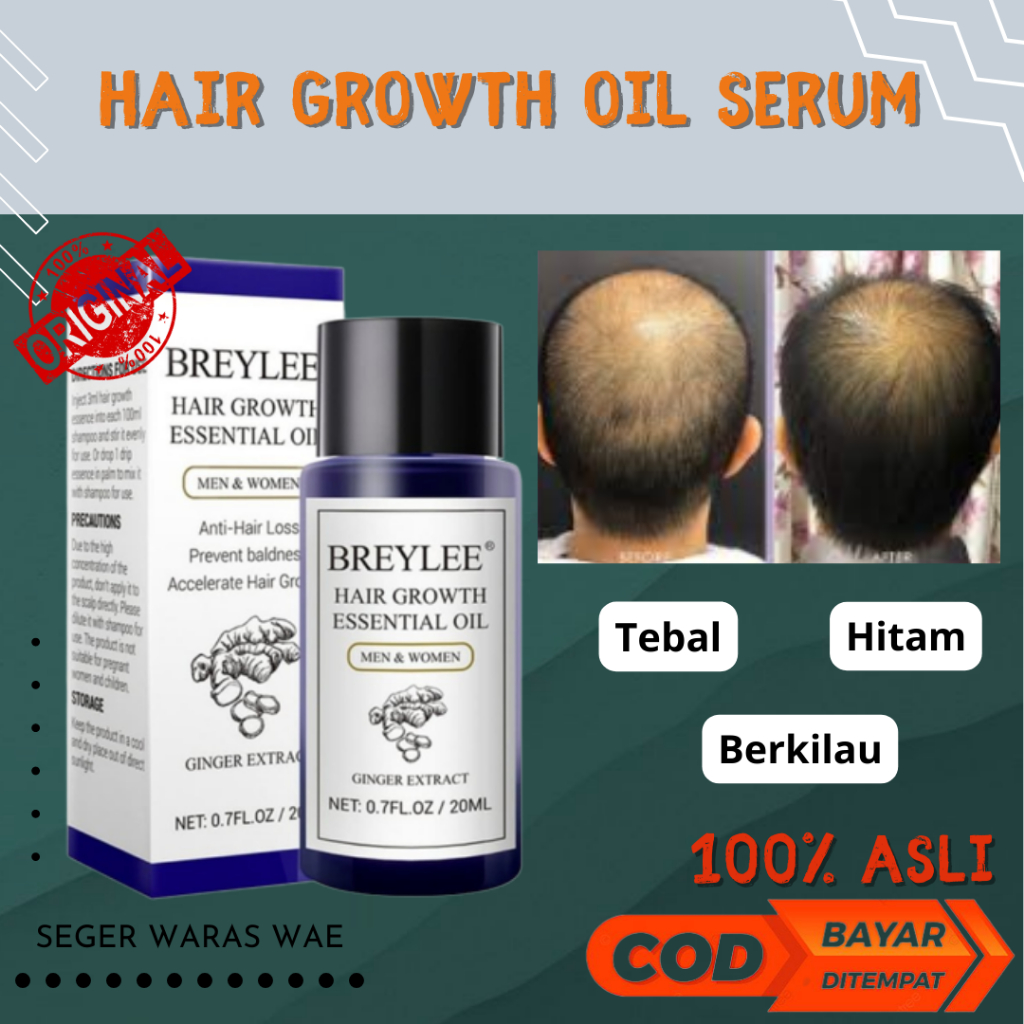 Jual PENUMBUH RAMBUT BOTAK ORIGINAL ESSENCE ANTI RONTOK / BOTAK ASLI ...