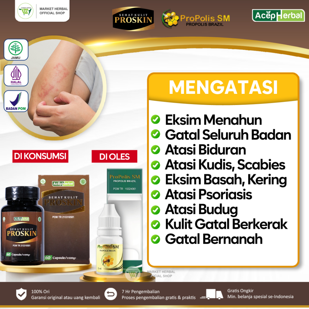 Jual Obat Eksim Kering Menahun Kurap Kudis Scabies Eksim Kering Basah ...