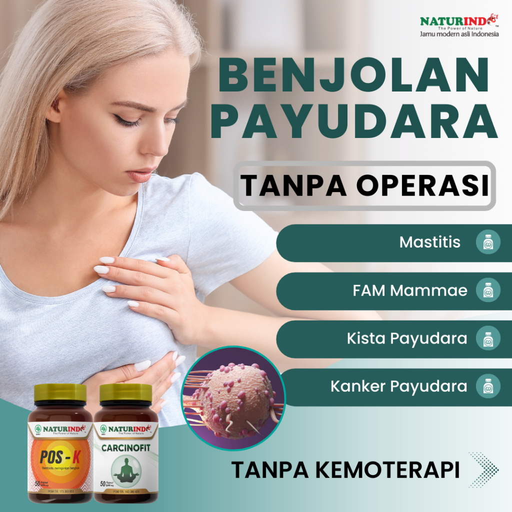 Jual Obat Benjolan Payudara FAM Mammae Kista Mastitis Bengkak Herbal Alami | Shopee Indonesia