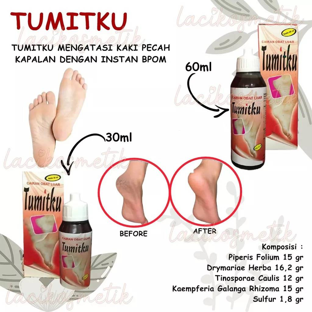 Jual Tumitku - Obat Kapalan dan Kaki Pecah-Pecah 30ml - mata ikan 100% ...