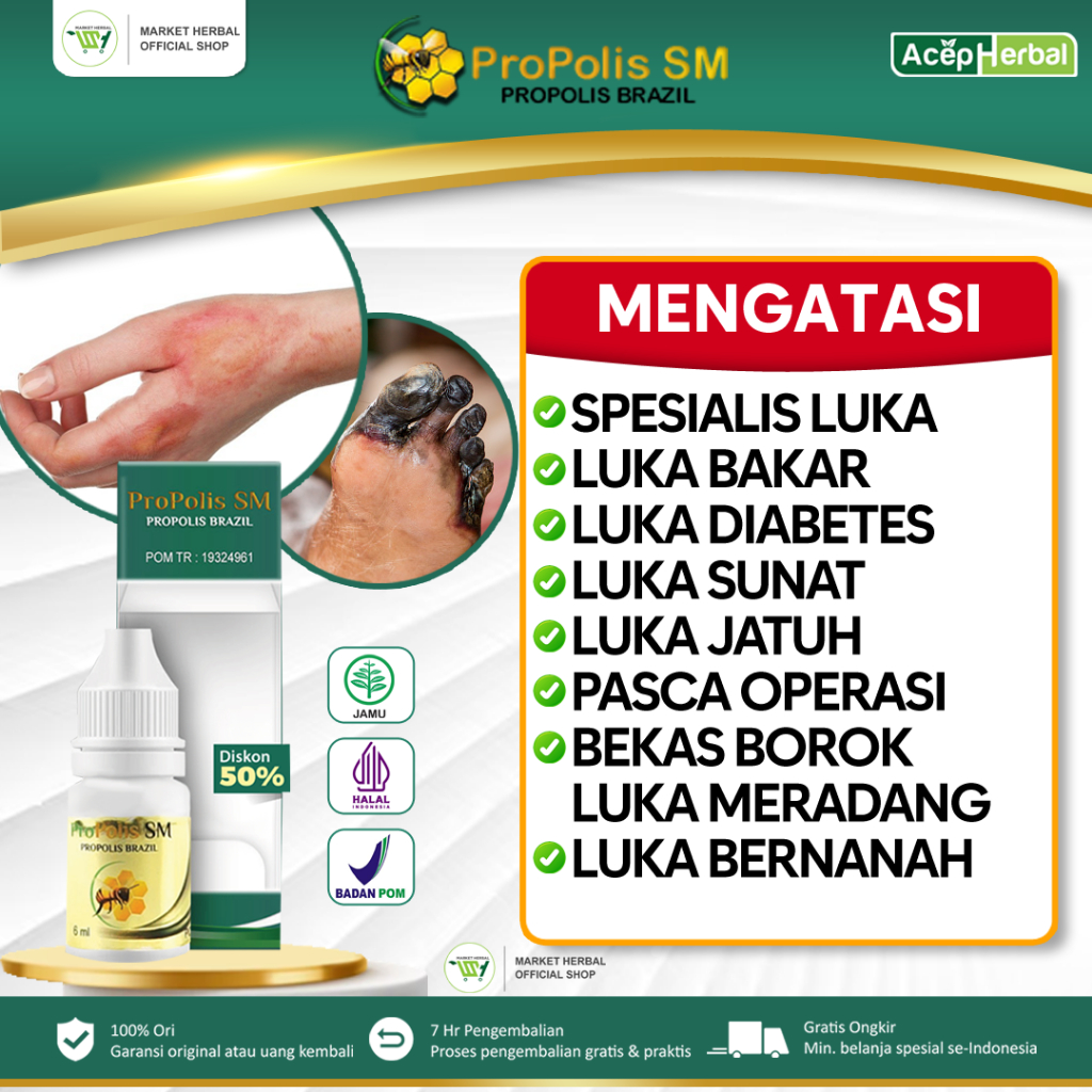 Jual Obat Spesialis Pengering Luka Basah Bernanah, Luka Diabetes ...