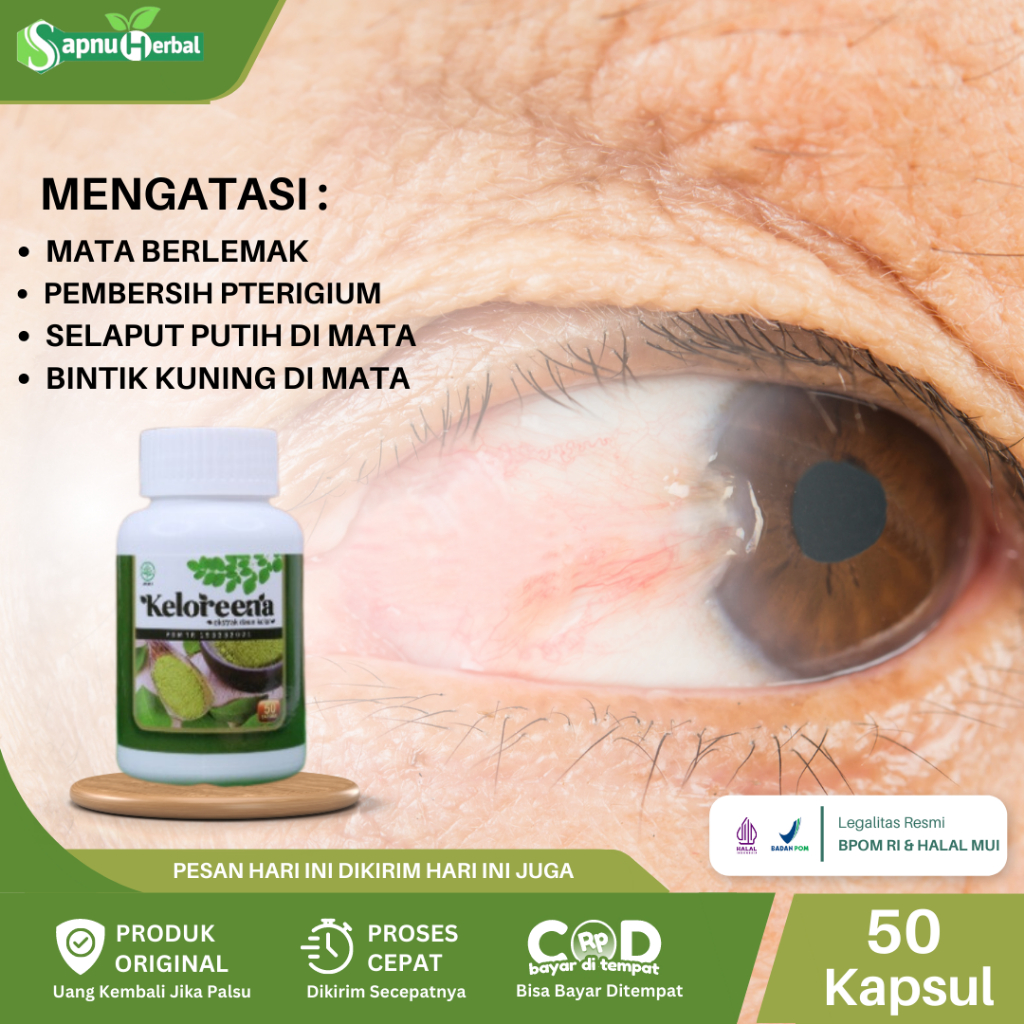Jual Obat Mata Berlemak, Mata Berlemak Kekuningan, Pembersih Pterigium, Penghilang Selaput Putih ...