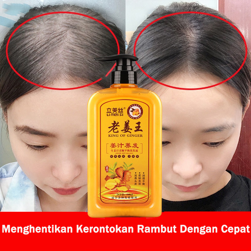 Jual Shampo Jahe 500ml Penumbuh Rambut Tebal Anti Ketombe Gatal Rontok Fast Grow Shampo anti ...