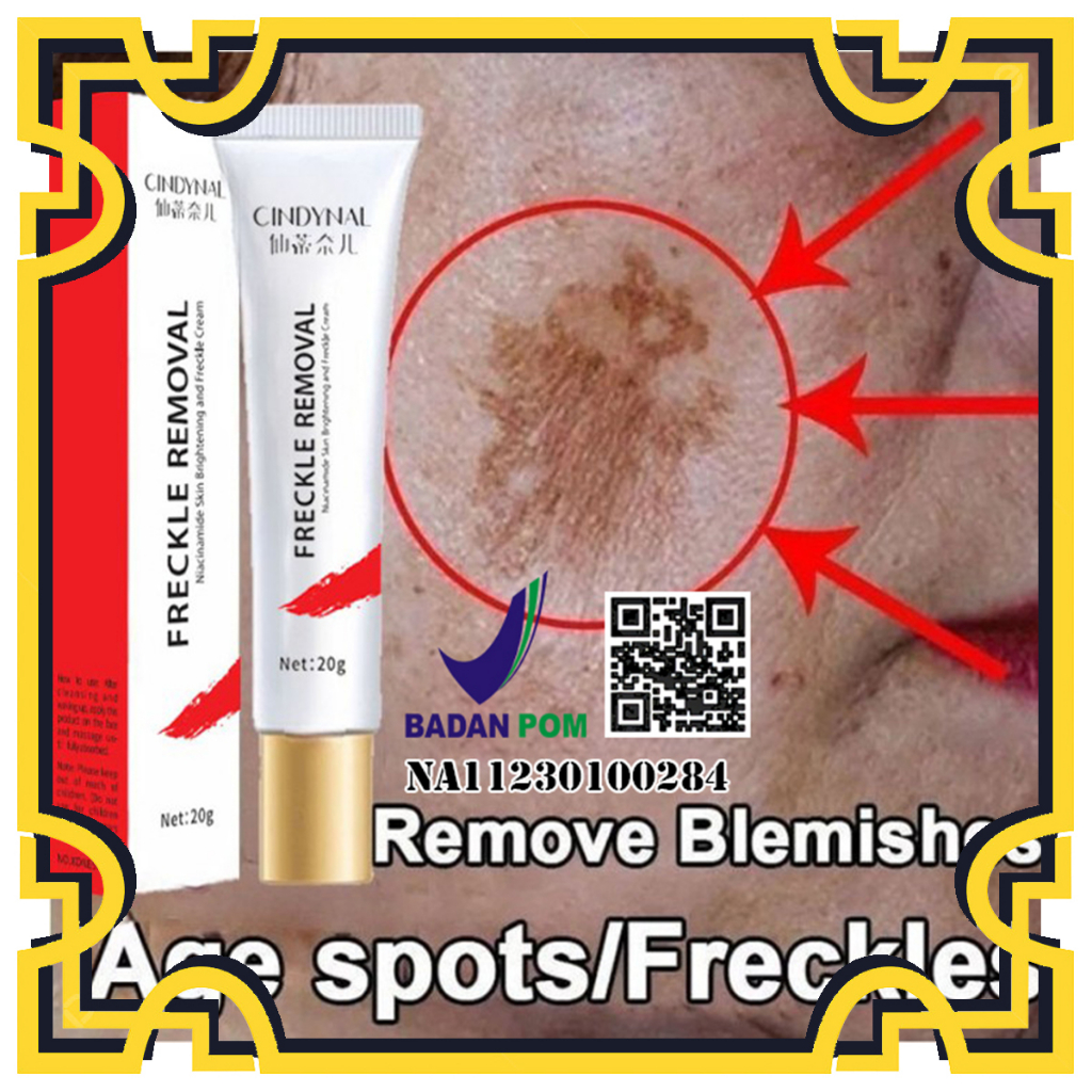 Jual HS BPOM CINDYNAL SALEP PENGHILANG FLEK HITAM CREAM PENGHILANG BINTIK BEKAS JERAWAT [ RESMI ...