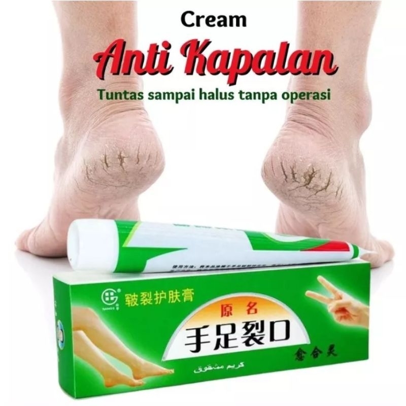 Jual ‼️READY‼️SALEP TUMIT AMPUH IJO - OBAT KAKI PECAH PECAH - CREAM ...
