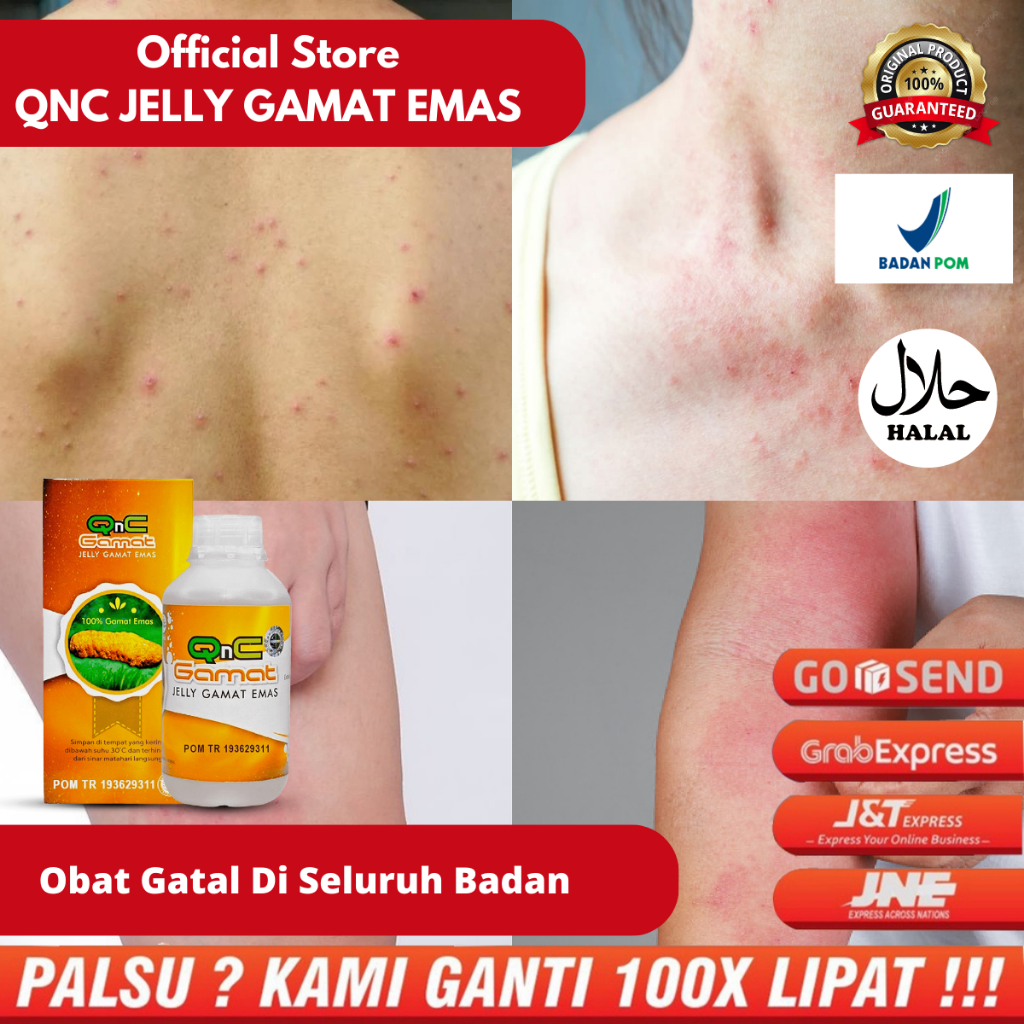 Jual Obat Gatal Di Seluruh Badan, Obat Centengan Jempol Kaki Kuku Rusak ... Jual Obat Gatal Di Seluruh Badan, Obat Centengan Jempol Kaki Kuku Rusak ...