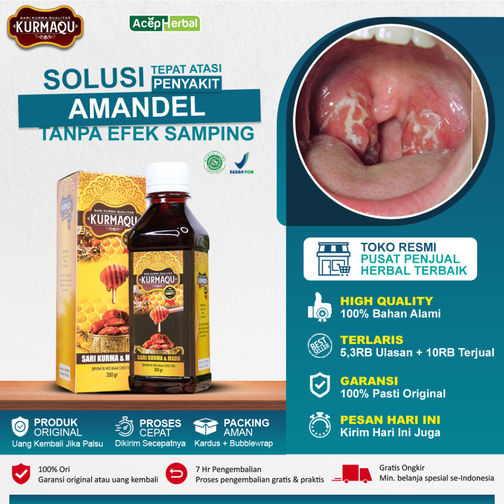 Jual Obat Herbal Khusus Amandel Anak dan Dewasa, Sakit Tenggorokan, Susah Nelan, Sakit Menelan ...