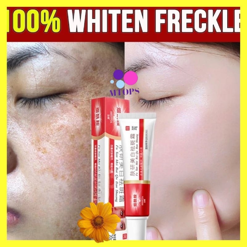 Jual Whitening And Freckle Removal Cream Krim Pemutih Wajah Bintik Dan Penghilang Flek Hitam ...