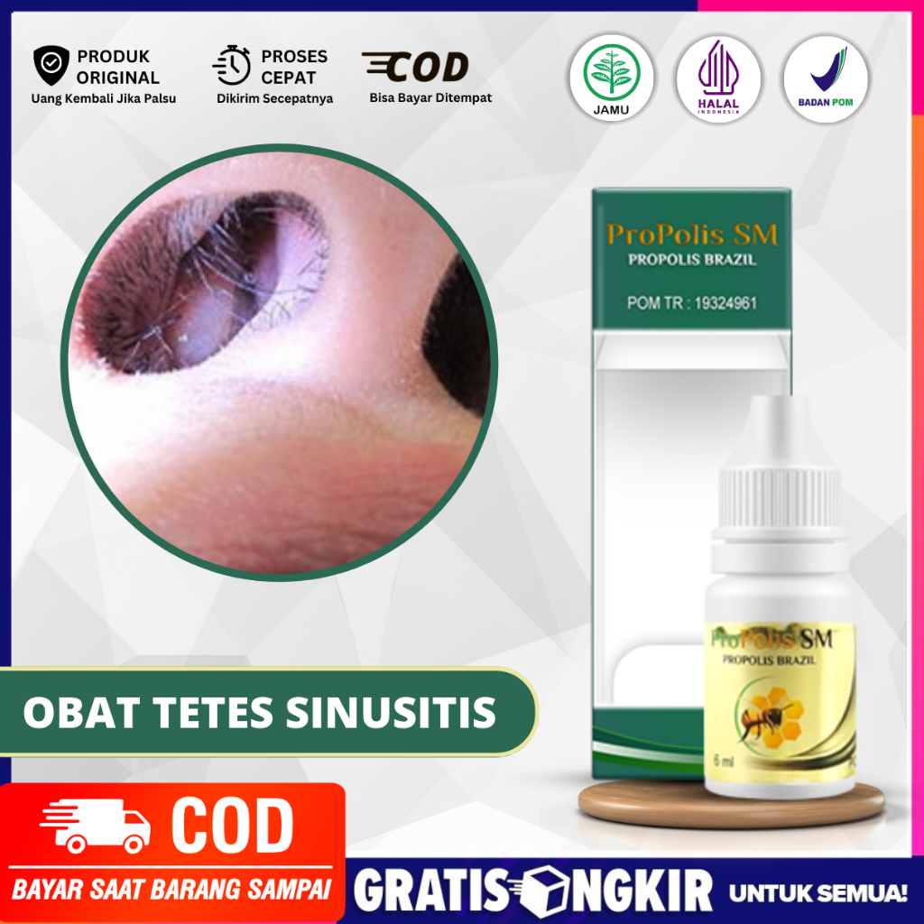 Jual Obat Khusus Sinusitis Akut Kronis - Radang sinus - Polip Hidung ...