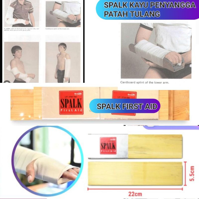 Jual Spalk Kayu First Aid Bidai Kayu Patah Tulang Spalk Kayu Penyangga ...