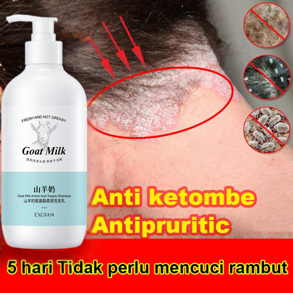 Jual shampoo anti ketombe dan rontok 500ml Anti Gatal perawatan rambut ketombe Garam Laut ...