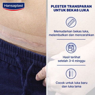 Jual Hansaplast Plester Bekas Luka XL JUAL SATUAN / LEMBAR ...