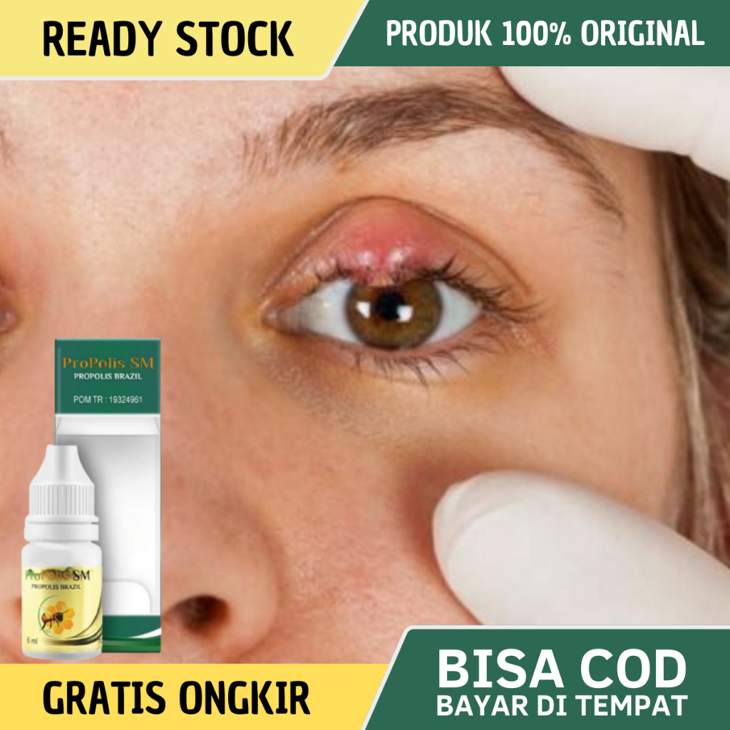 Jual Obat Bintitan, Obat Mata Bintitan, Obat Bintitan Anak Dan Dewasa ...