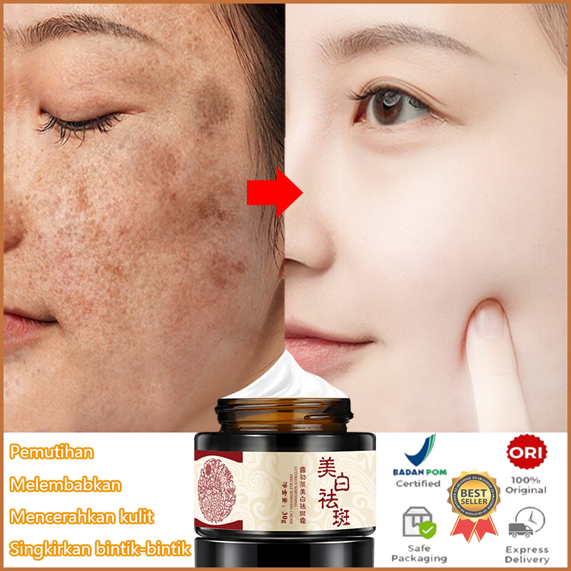 Jual Krim penghilang flek hitam Cream pemutih wajah Krim bintik pemutih Krim penghilang flek 30G ...