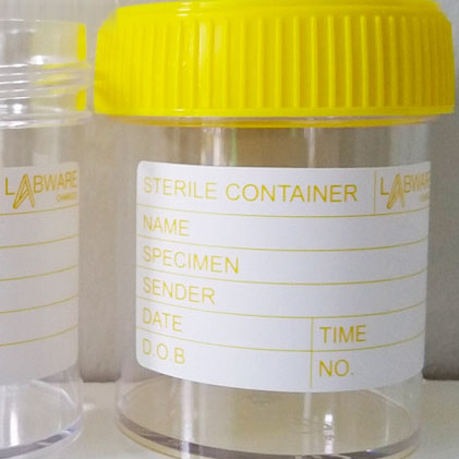 Jual Labware Sterile Urine Container 60 ml | Shopee Indonesia
