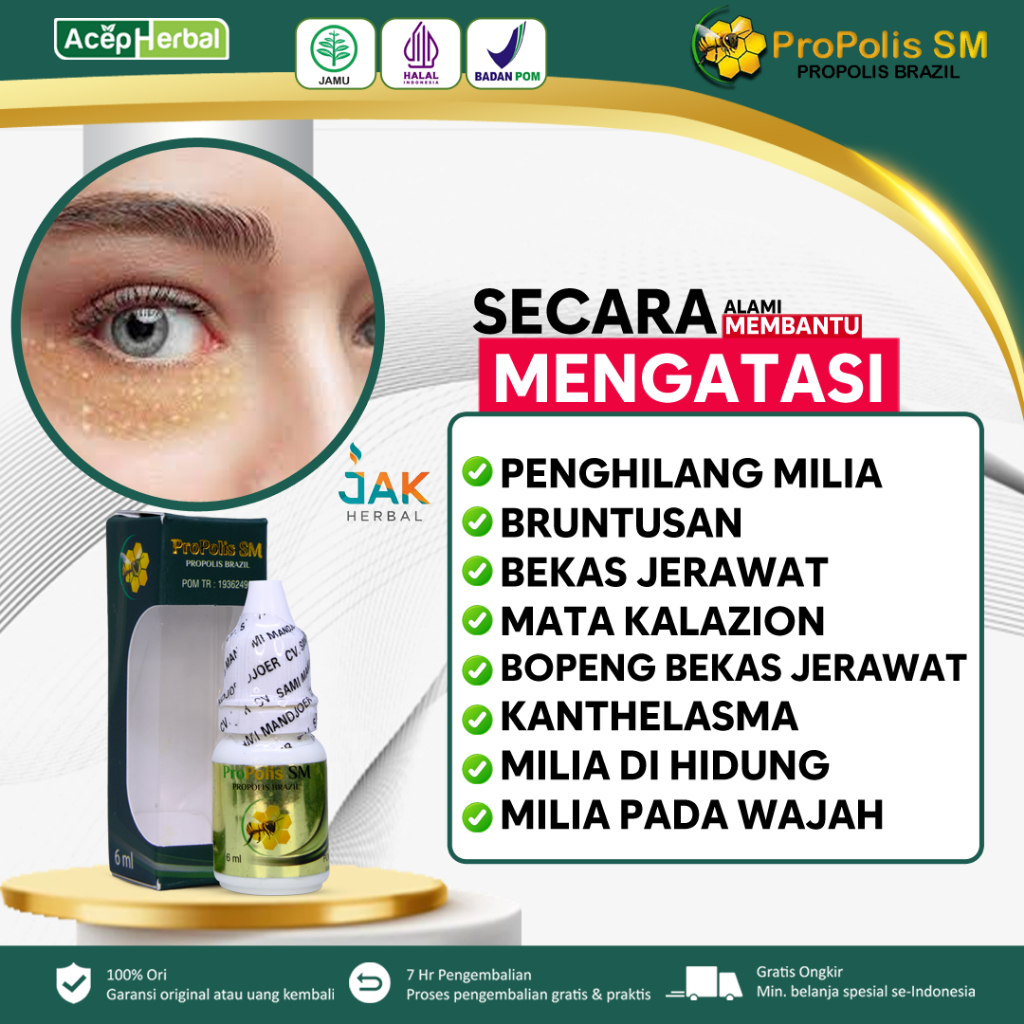 Jual Propolis SM - Obat Penghilang Milia di Bawah Mata Bintik Putih ...