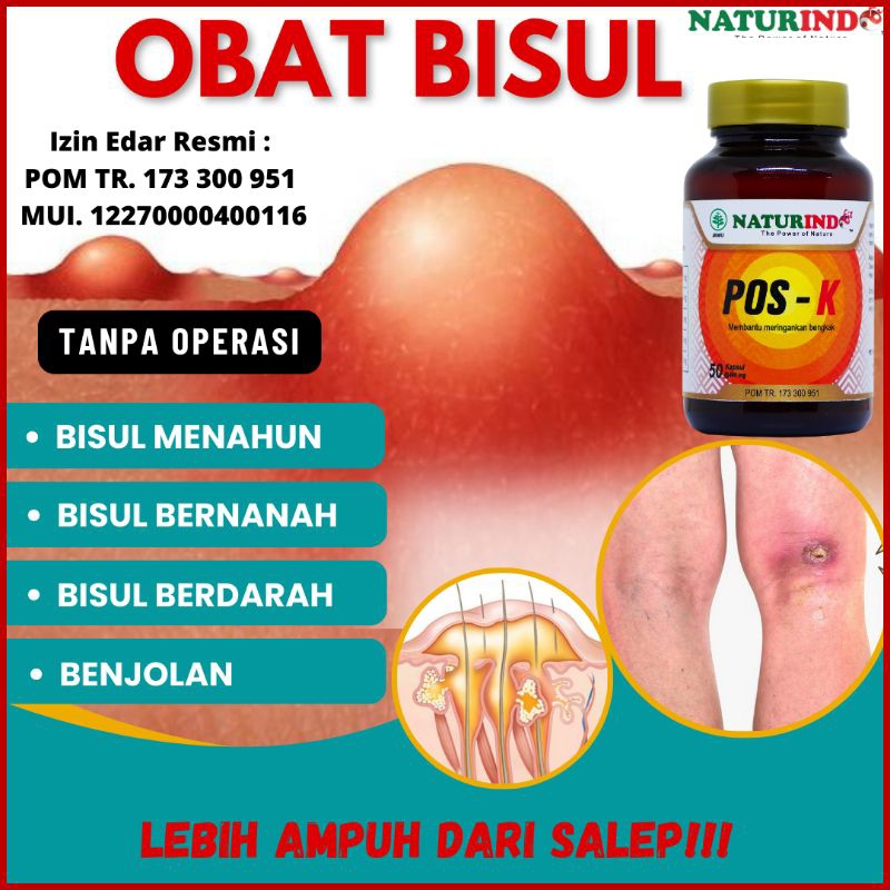 Jual Obat Bisul Ampuh Udun Bernanah Di Bokong Ketiak Wajah Leher Kutil Mata Ikan Wudun | Shopee ...