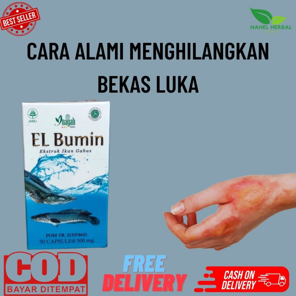 Jual Original! Pengering Luka Basah / Bakar - Kapsul Kutuk Ampuh ...