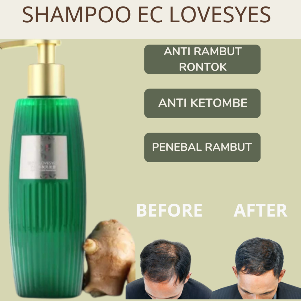 Jual SHAMPOO EC - ANTI HAIR LOSS SHAMPOO PERAWATAN RAMBUT RONTOK PENEBAL RAMBUT 300 ML | Shopee ...