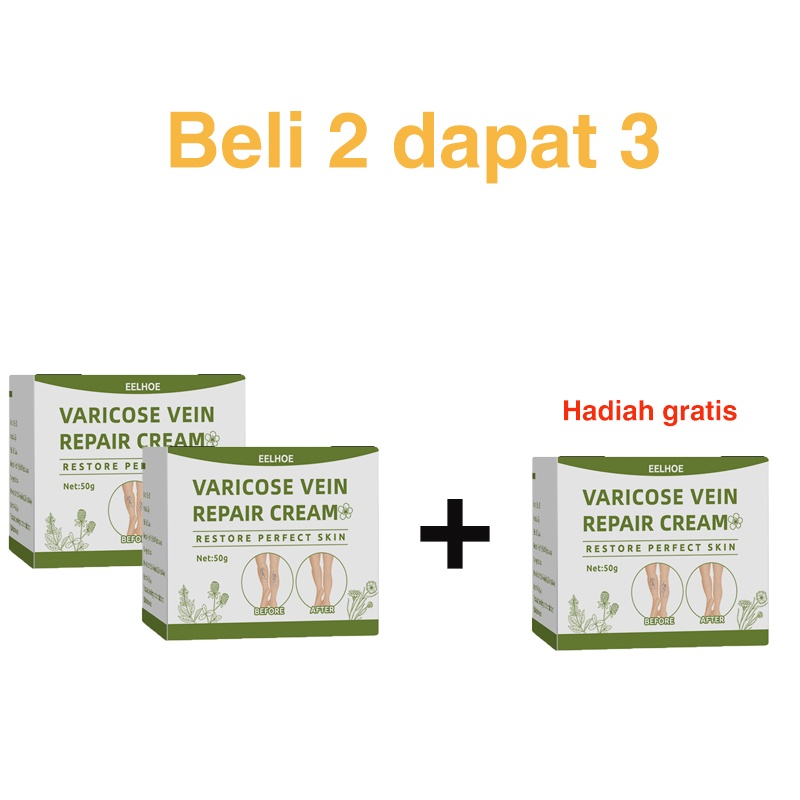 Jual Obat Varises Salep Varises Cream Varicose Veins Varikokel Bengkak ...
