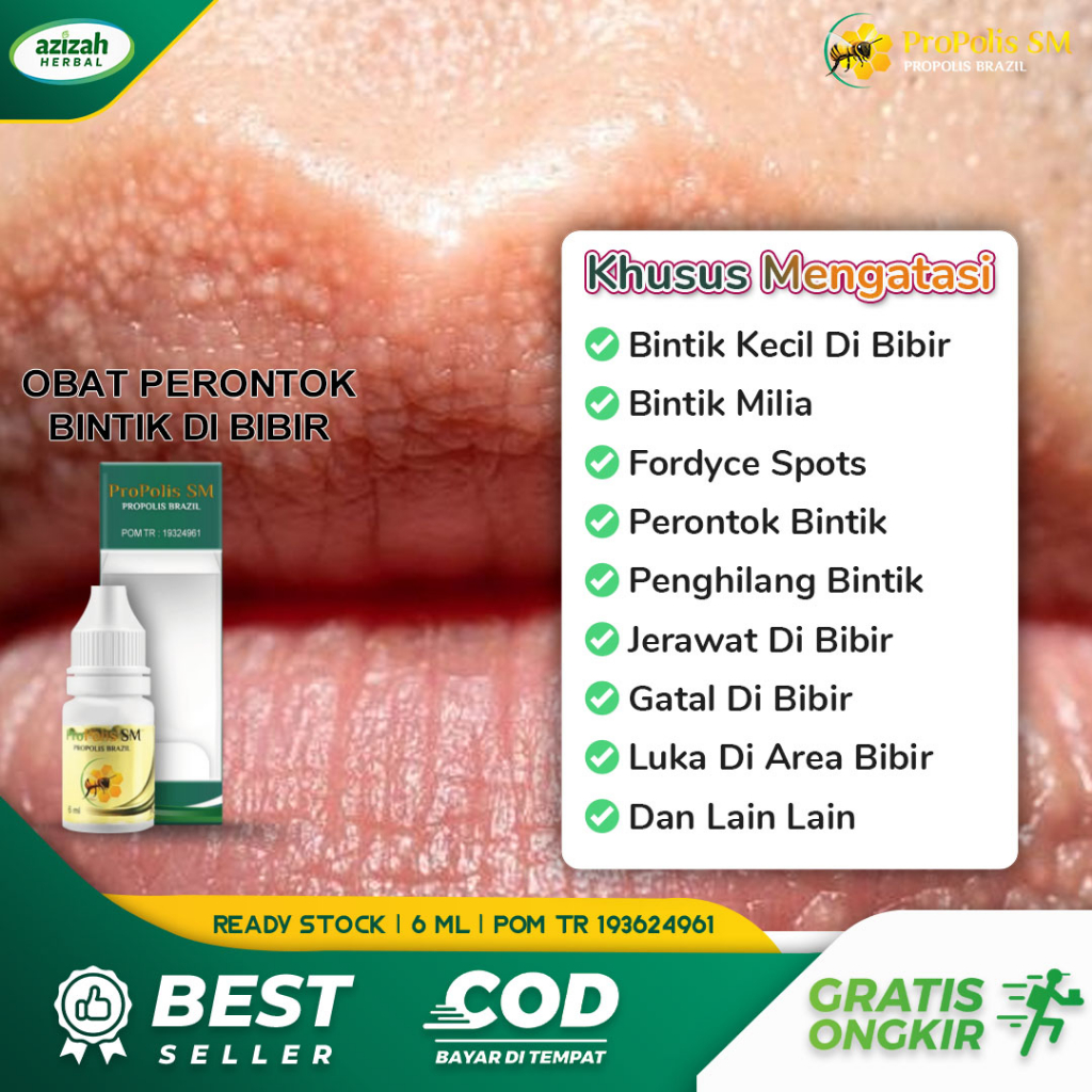 Jual Obat Bintik Putih Di Bibir Milia Fordyce Spots Perontok Bintik ...