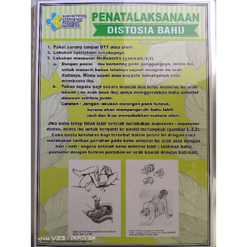 Jual (13) POSTER PENATALAKSANAN DISTOSIA BAHU | Shopee Indonesia