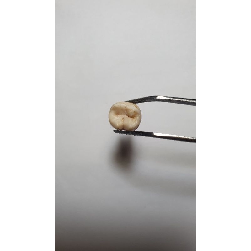 Jual Gigi Praktikum Molar Dua Bawah Kanan/ Gigi Asli Graham Bawah ...