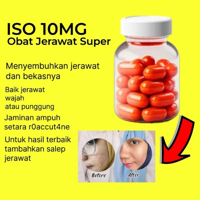 Jual Obat Jerawat, Bekasnya dan Kulit Berminyak Ampuh Original ...