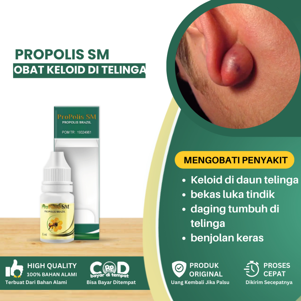 Jual Obat Keloid Di Daun Telinga, Bekas Luka Tindik, Daging Tumbuh Di ...