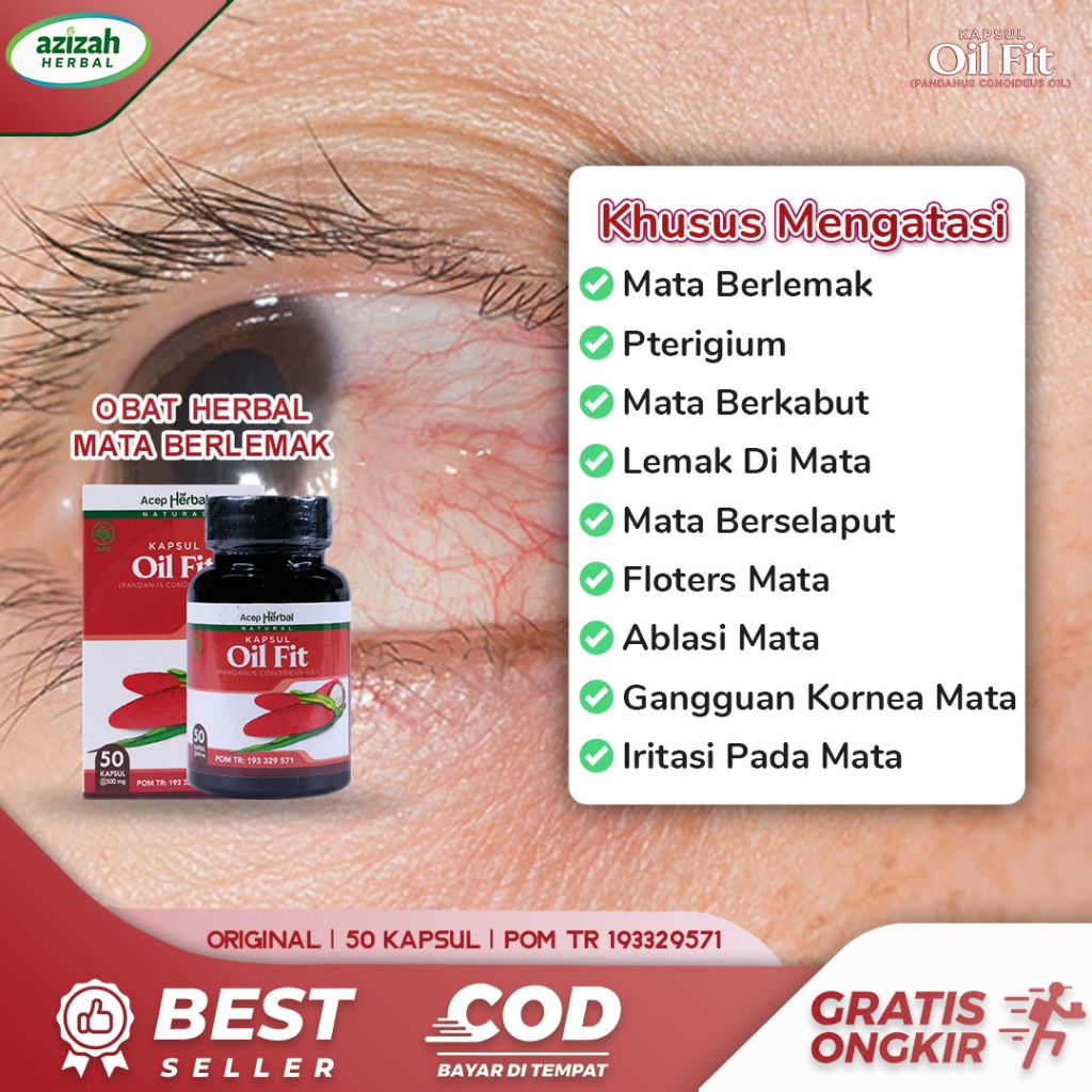 Jual Obat Mata Berlemak Pterygium Bola Mata Kuning Berselaput Glukoma ...