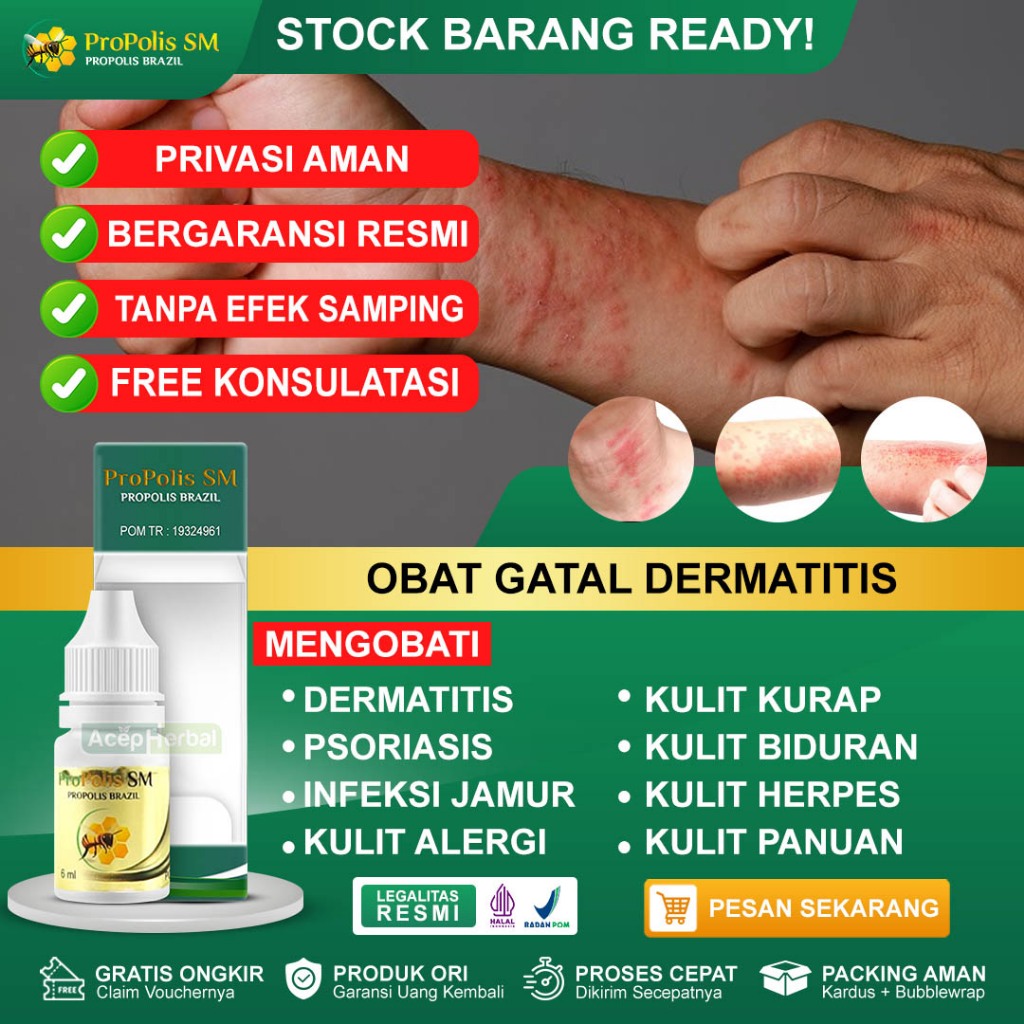 Jual Obat Gatal Kulit Dermatitis Psoriasis Infeksi Jamur Kulit Alergi ...